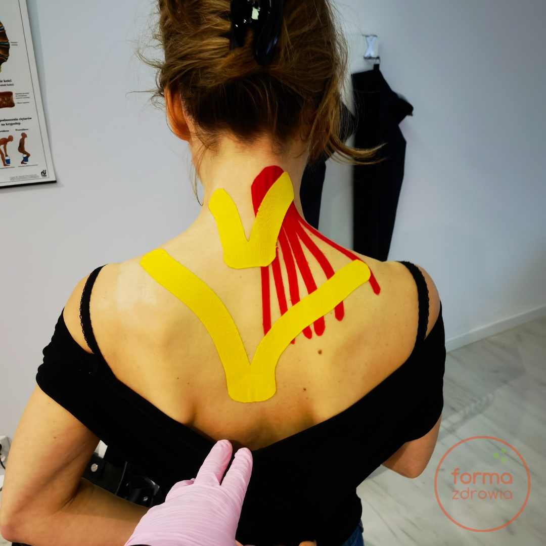 Kinesiology taping Szczecin - Forma Zdrowia